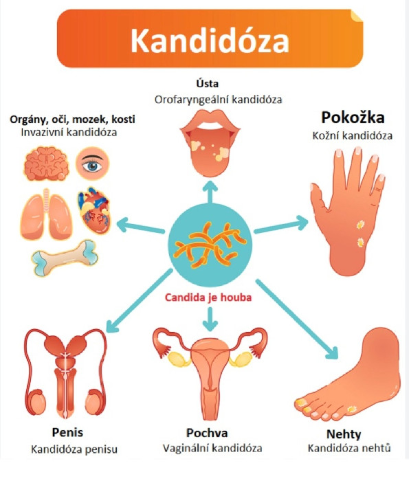 TEST NA KANDIDOZU :: Zdravé povídání